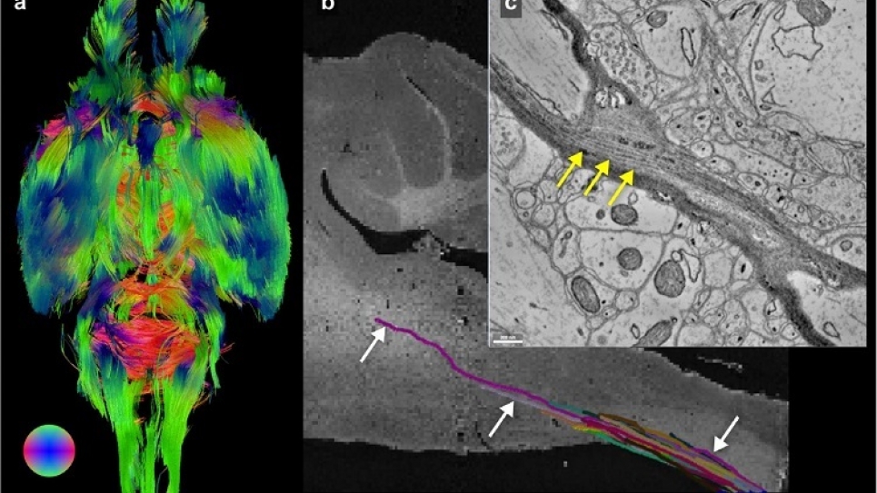 New Imaging Pipeline Captures Synapse to Whole Brain on One Sample | Argonne Leadership ...